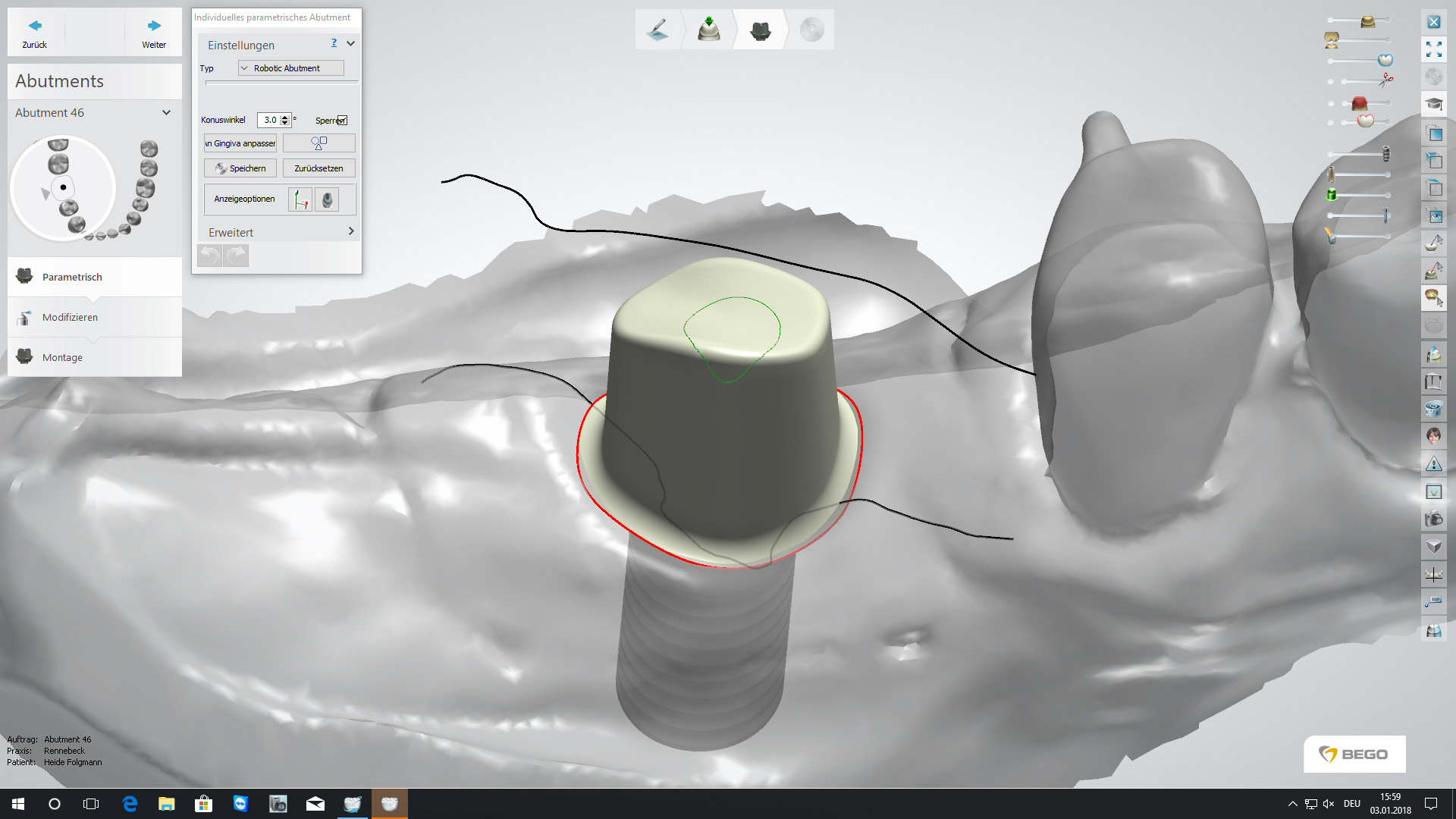 Dental Thorwarth - Portfolio - Dental Thorwarth